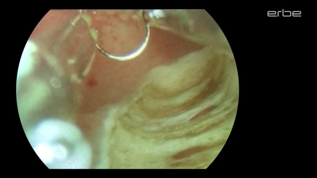 Gynäkologie Archive - Medical Videos