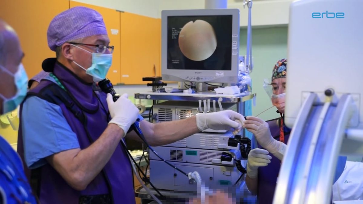 ERBECRYO 2 Archive - Medical Videos