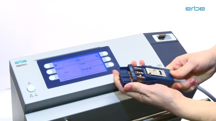 Cryosurgery Archive - Medical Videos