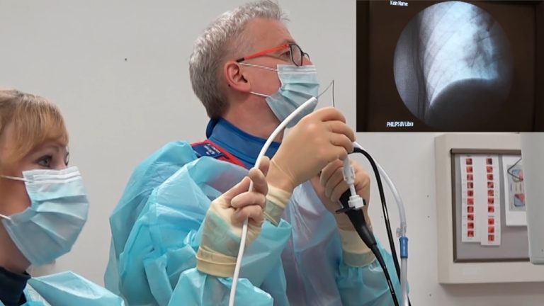 bronchoscopy Archive - Medical Videos