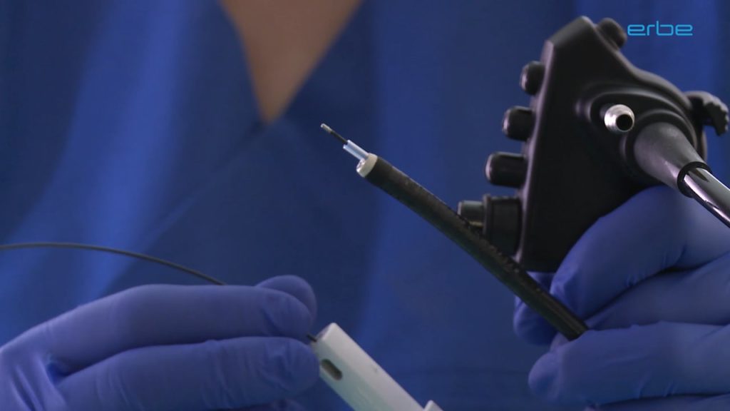 Cryosurgery Archive - Medical Videos