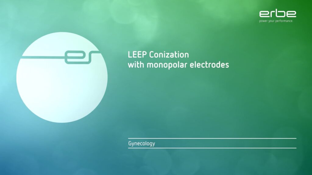 gynecology Archive - Medical Videos