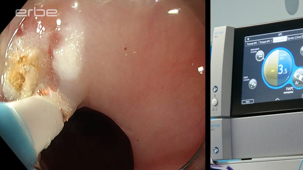 CPS Archive - Medical Videos